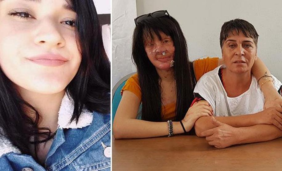 Berfin Özek kimdir, olayı nedir? Yüzüne asit atan Casim Ozan Çelik ile ...