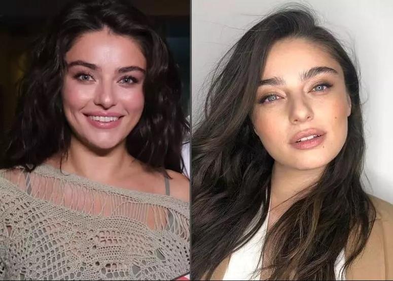 Ayça Ayşin Turan'ın yüzündeki değişim dikkat çekti... Sana ne oldu Ayça ...