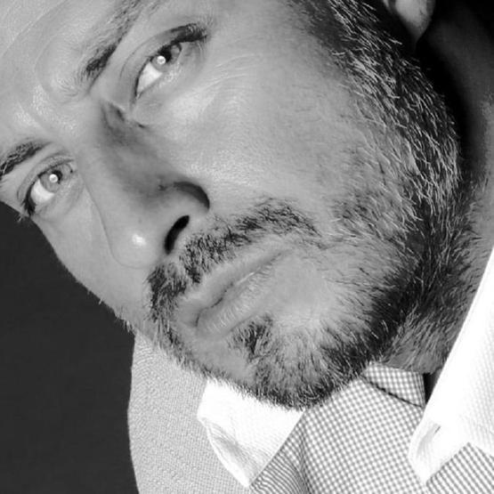 Popstar Selçuk'un son hali şaşırttı! Hollywood yakışıklı görsün ...