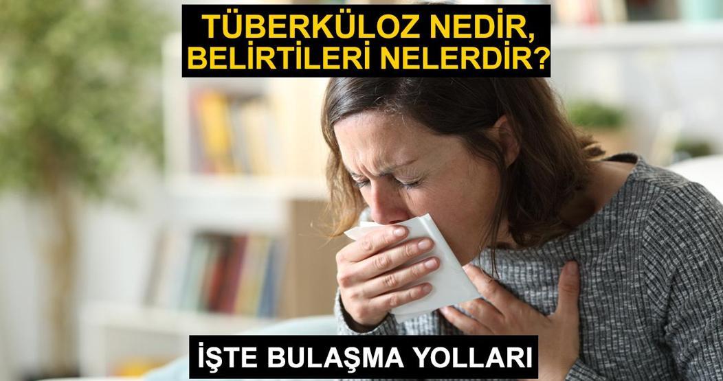 Tüberküloz nedir, nasıl bulaşır? Tüberküloz belirtileri nelerdir ...