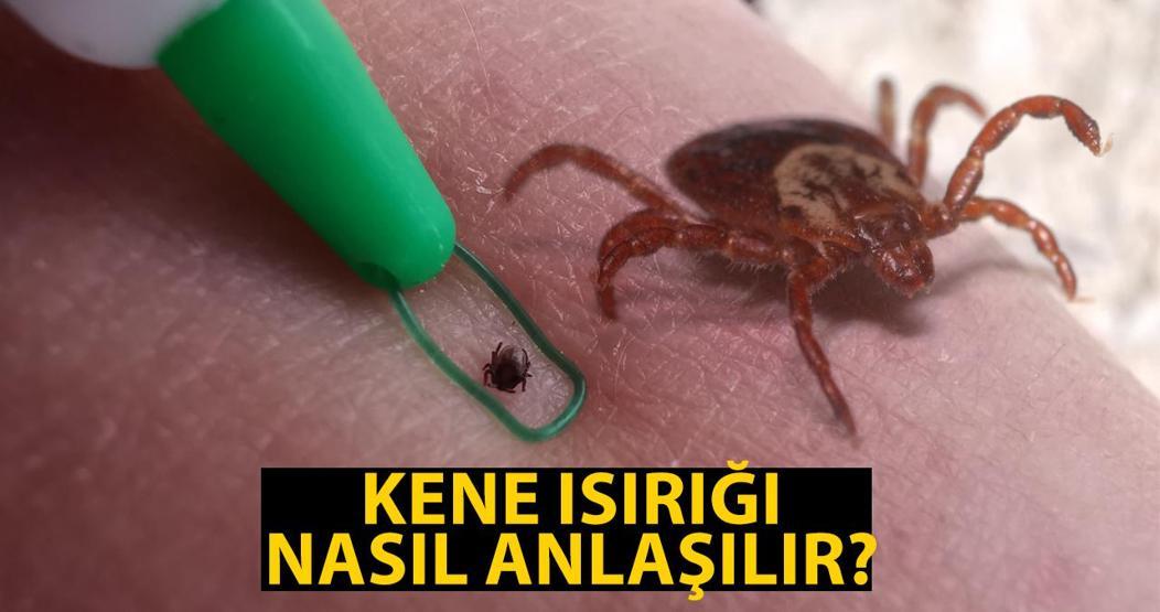 Kene ısırığı belirtileri: Kene ısırığı nasıl anlaşılır, ilk yapılması ...