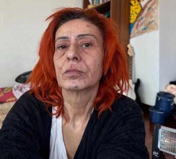 Yıldız Tilbe'nin yeni tarzı olay oldu! Beğeni butonu çöktü: 'YAŞAYAN ...