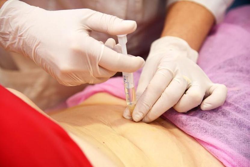 Mezoterapi Nedir? Hangi Durumlarda, Nasıl Uygulanır? Mezoterapi Ne İşe Yarar?