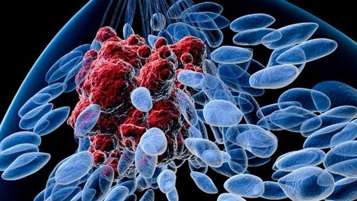 Kanser tedavi sürecinde bunlara dikkat! - Sağlık Haberleri