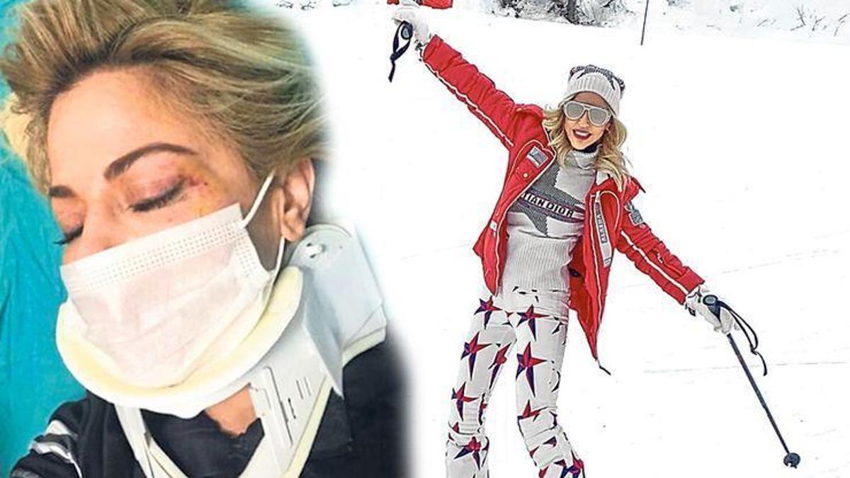 Burcu Şendir kayaktan vazgeçmedi - Son Dakika Magazin Haberleri