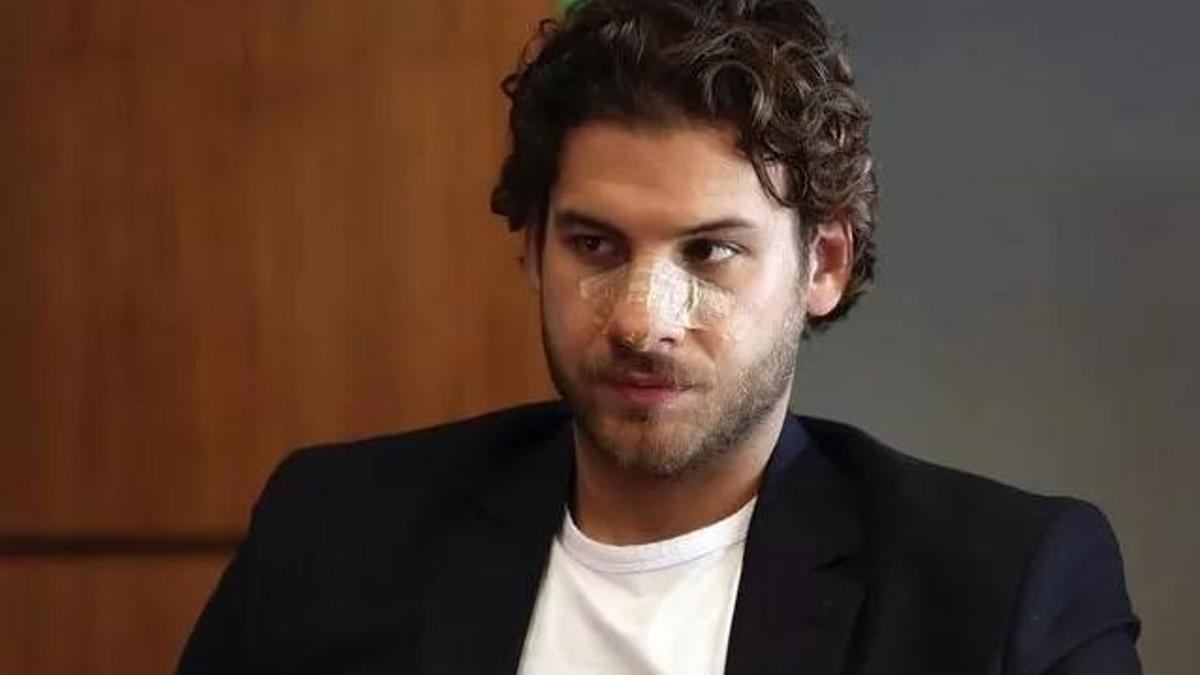 Mustafa Mert Koç'tan estetik açıklaması! Gerçek başka çıktı - Magazin ...