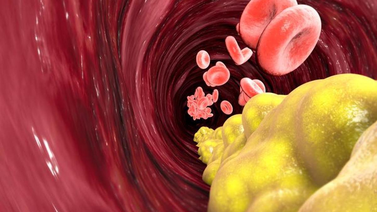 Trigliserid nedir, neden yükselir? Trigliserid nasıl düşer ve ...