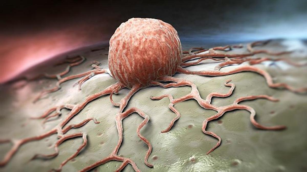 Kanser Çeşitleri Nelerdir? En Çok Bilinen Kanser Çeşitleri... - Sağlık ...