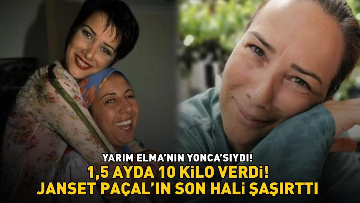 Yarım Elmanın Yoncası Janset Paçal'ın son hali şoke etti! 1,5 AYDA 10 ...