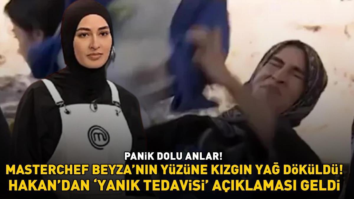 SON DAKİKA HABERİ: Yüzüne kaynar yağ dökülen Beyza acil olarak hastaneye kaldırıldı! Hakan'dan ...
