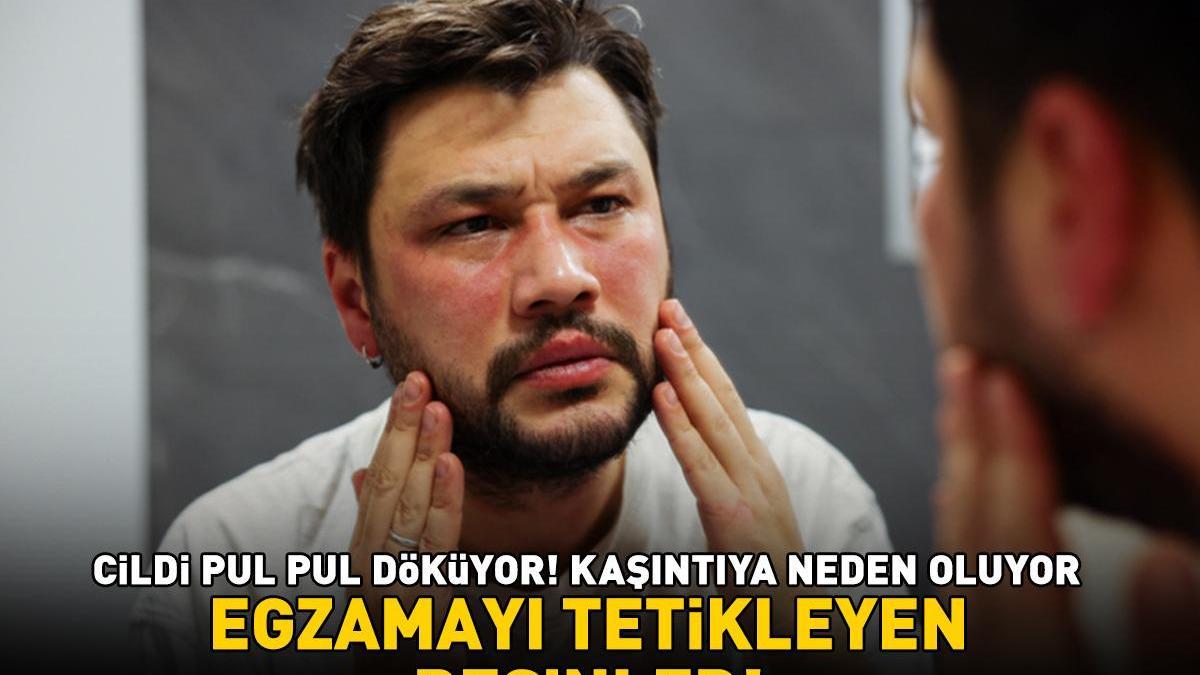 Egzamayı tetikliyor! Cildi pul pul döküyor, kaşıntıya neden oluyor! Bu ...