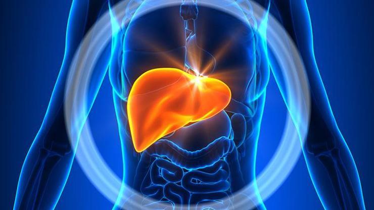 Siroz nedir, nedenleri nelerdir, nasıl tedavi edilir?